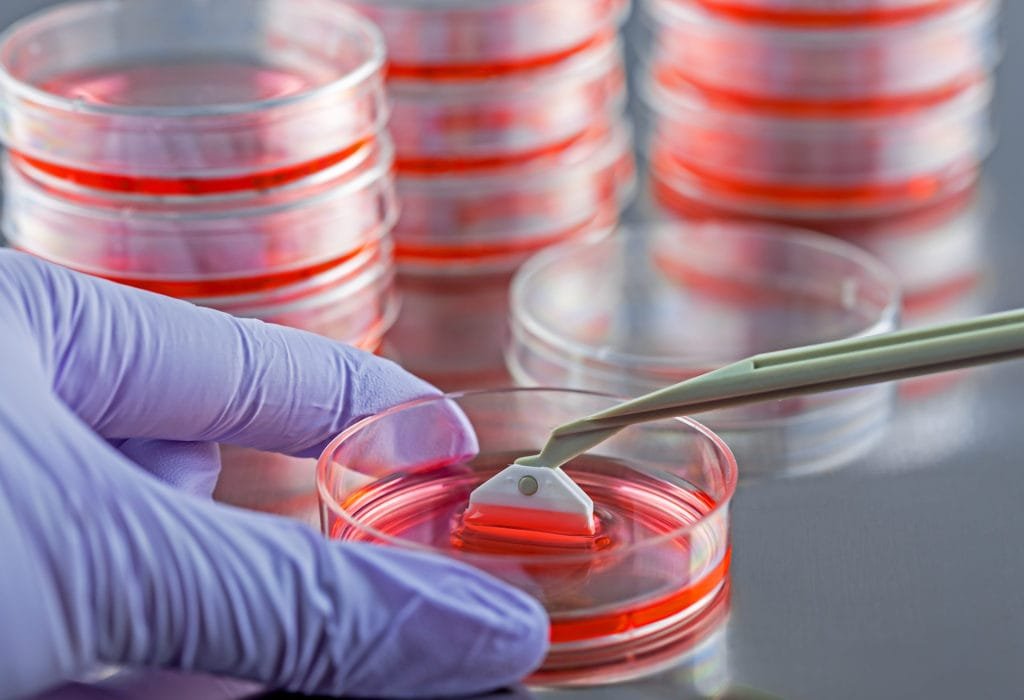 Tissue Banking Market Growth Analysis Report 2023 to 2030 - LinkeWire